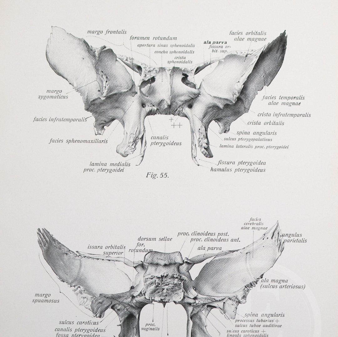 Sphenoid Bone / Temporal Bone /- Human Anatomy - Descriptive Anatomy ...