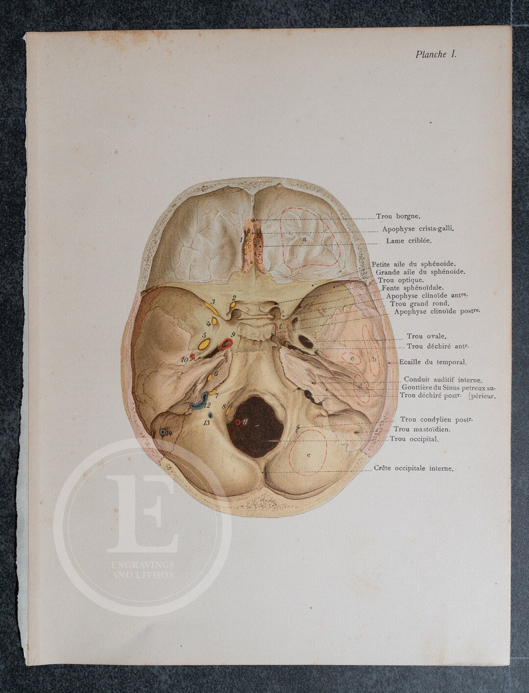 Skull Base Viewed From Above - Human Anatomy - Topographic Anatomy Book ...
