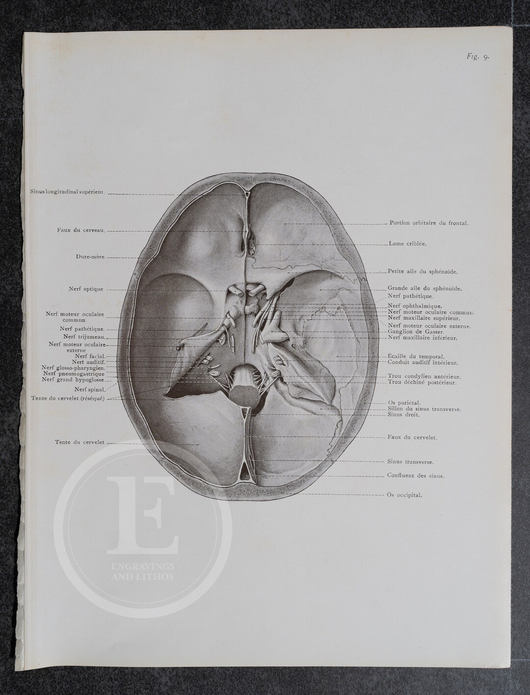 Base of the Skull With Cranial Nerves After Removal of the Brain- Human ...
