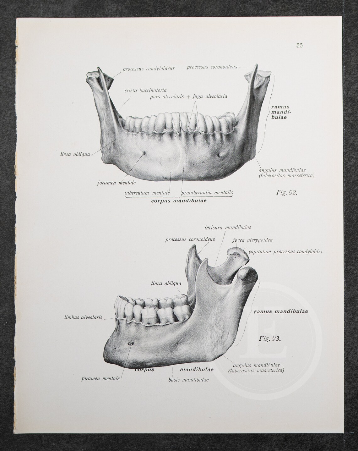 Lower Jaw/ Hyoid Bone / Human Anatomy - Descriptive Anatomy Book From ...
