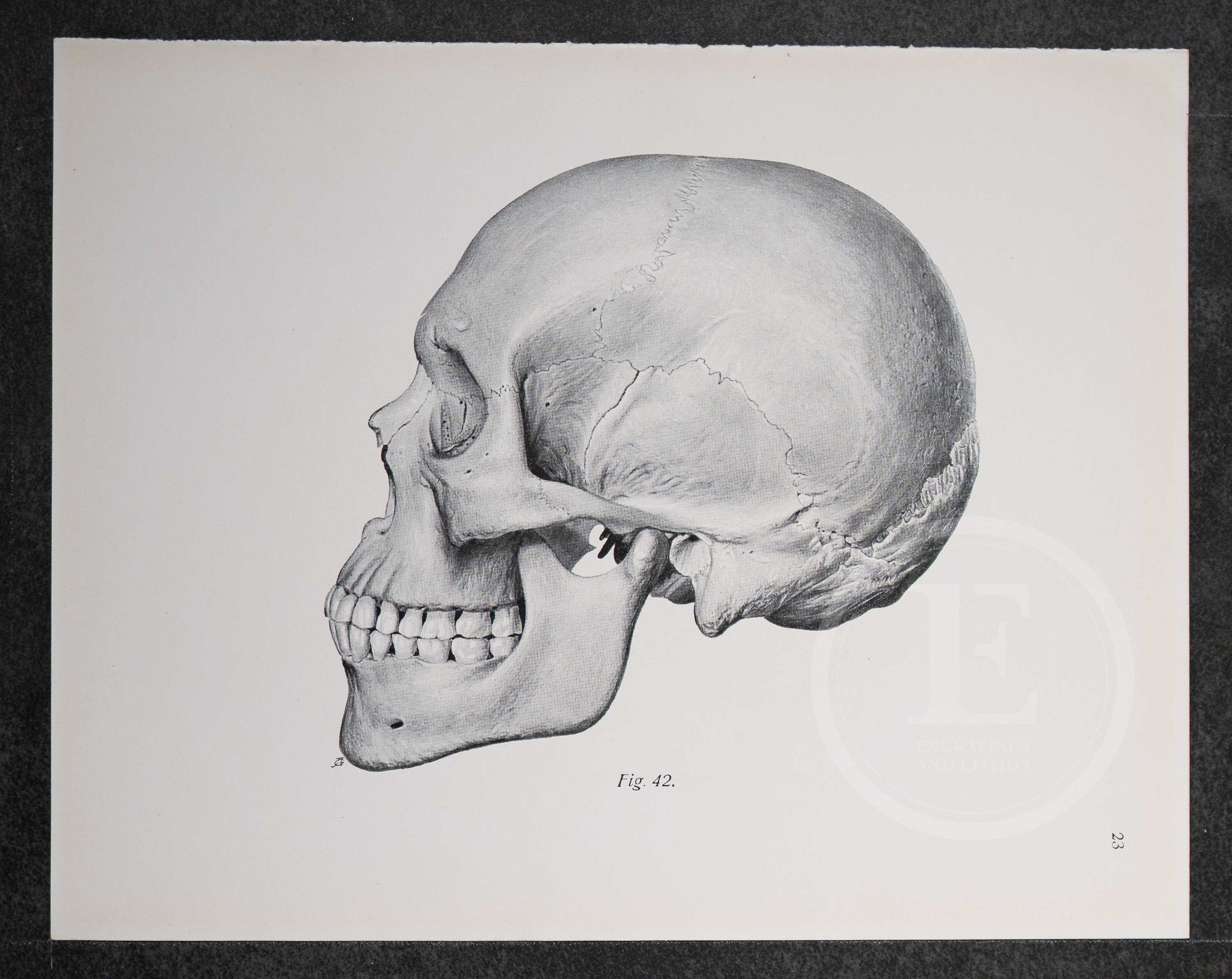 Left Side of the Skull / Outer Skull Base / Human Anatomy - Etsy