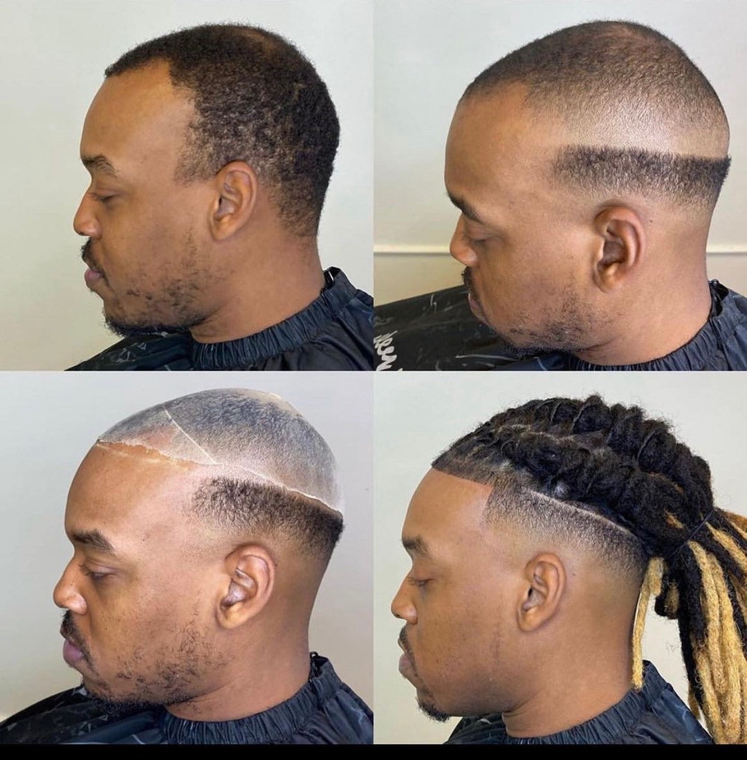 Men's Hair System | Natural Hairline Toupee | Custom Lace Wig for Men ...