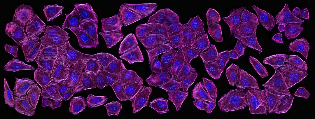 Cytoskeleton (purple) - Science Art Print on Paper, Canvas, Acrylic ...