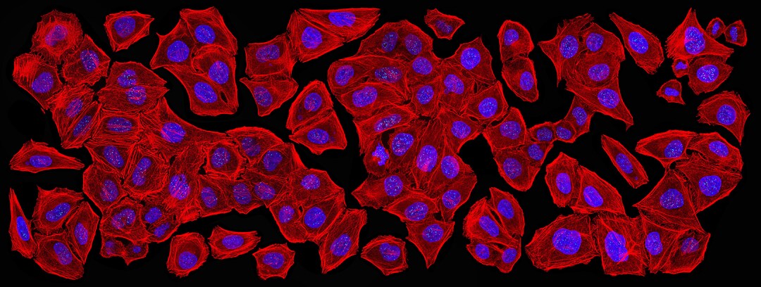 Cytoskeleton (red) - Science Art Print on Paper, Canvas, Acrylic ...