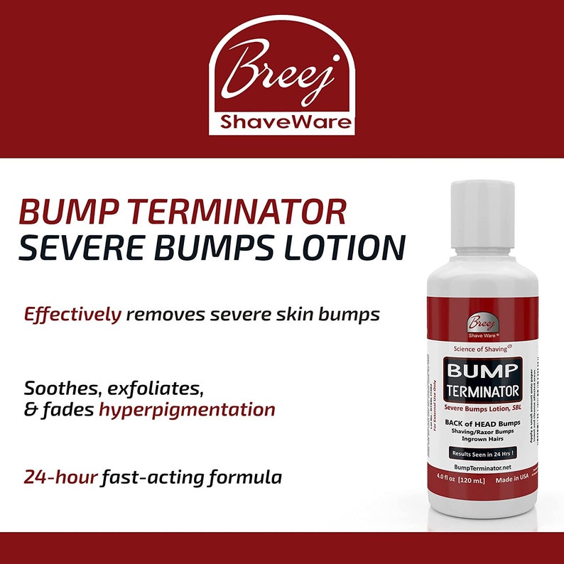Bump Terminator Severe Bumps Lotion (4oz) - Etsy