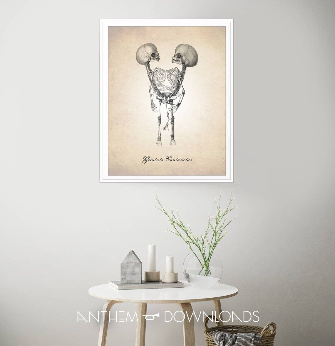 Conjoined Twins Art Print Anatomy Drawing Human Anatomy - Etsy