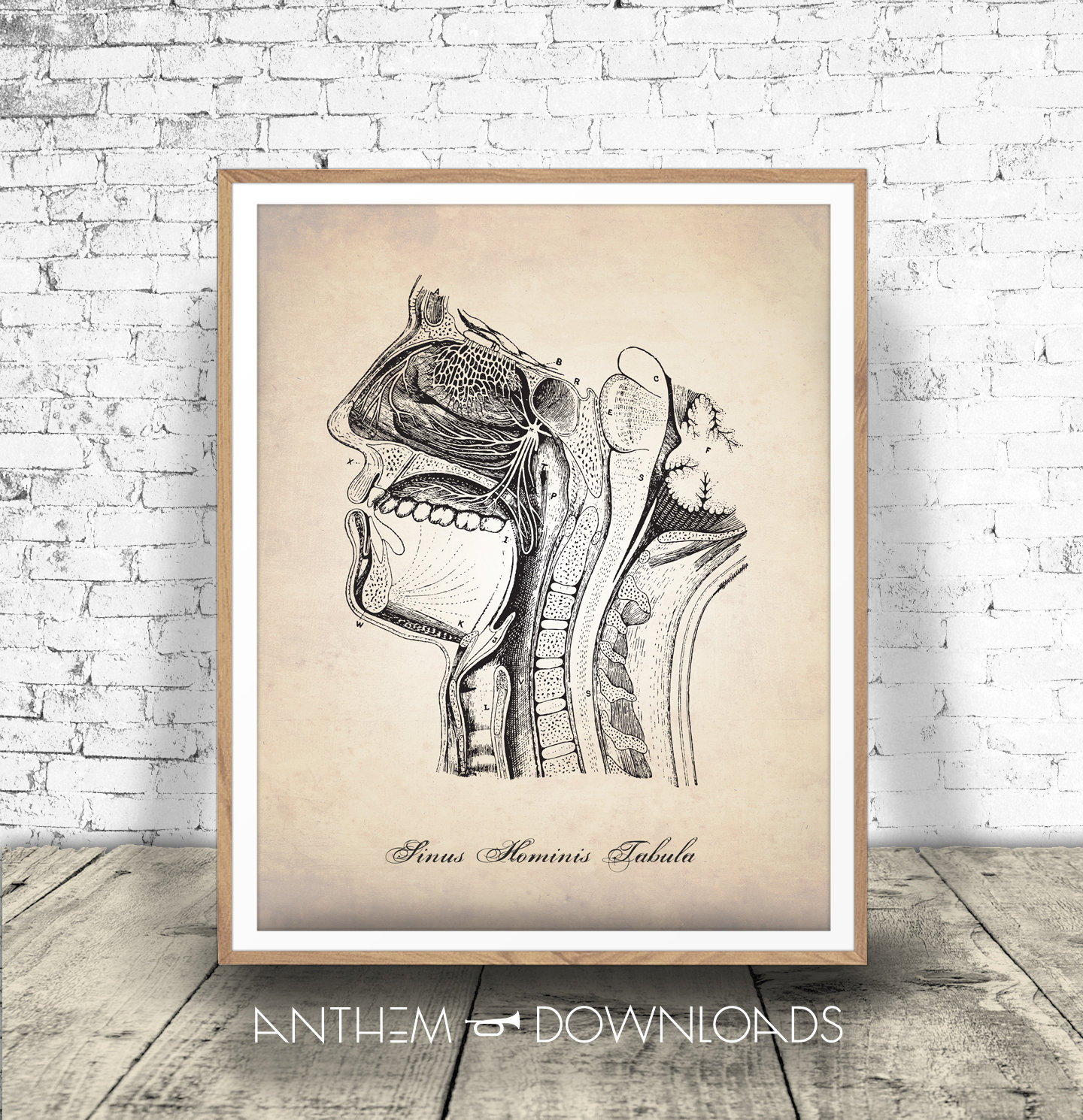 Human Anatomy Print - Sinus Diagram - Cross Section Illustration ...