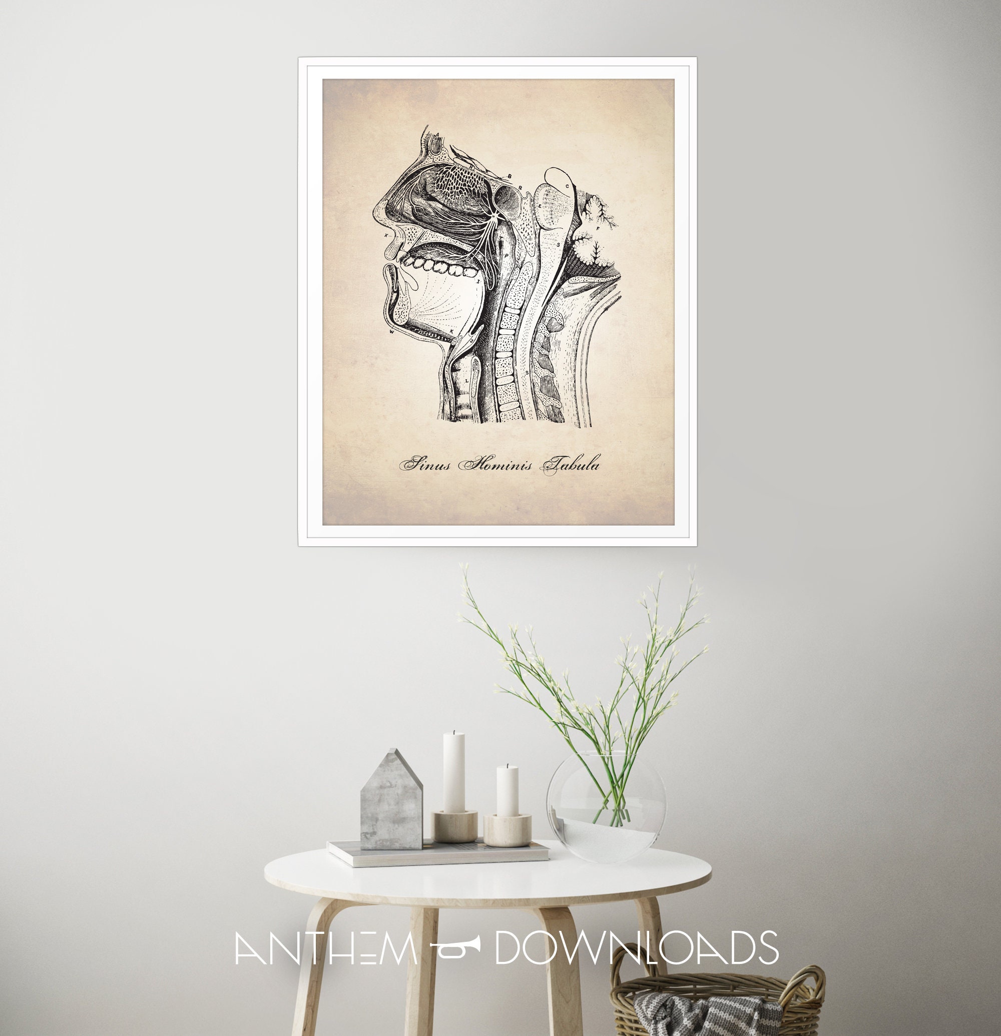 Human Anatomy Print - Sinus Diagram - Cross Section Illustration ...