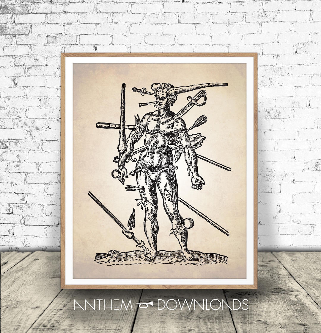 Wounds Man Art Print - Human Anatomy Printable - Anatomy Illustration ...