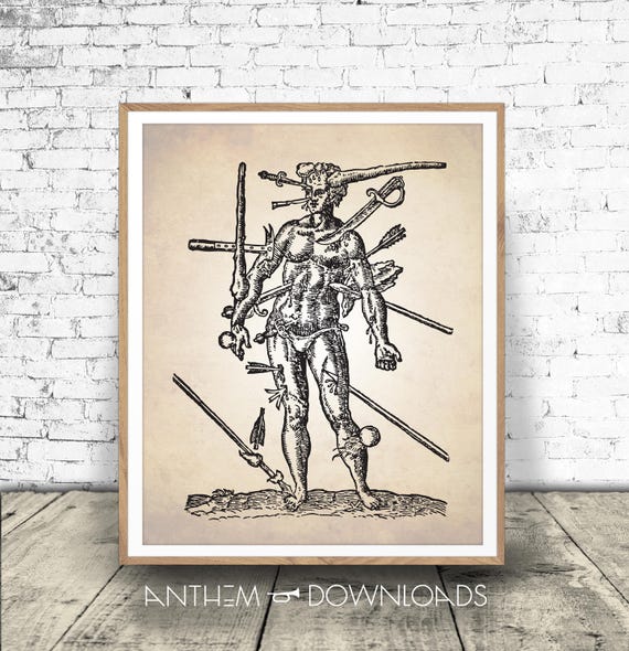 Wounds Man Art Print Human Anatomy Printable Anatomy - Etsy