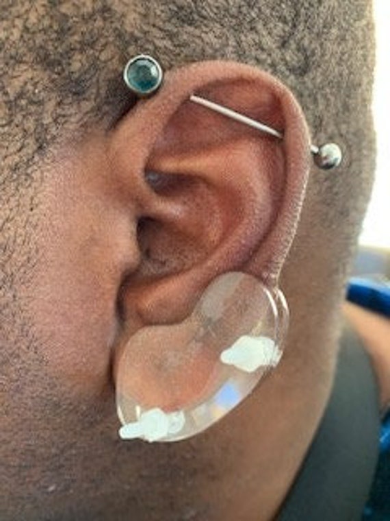 Ear Keloid Compression Plastic Discs Plastic Disc Earring - Etsy