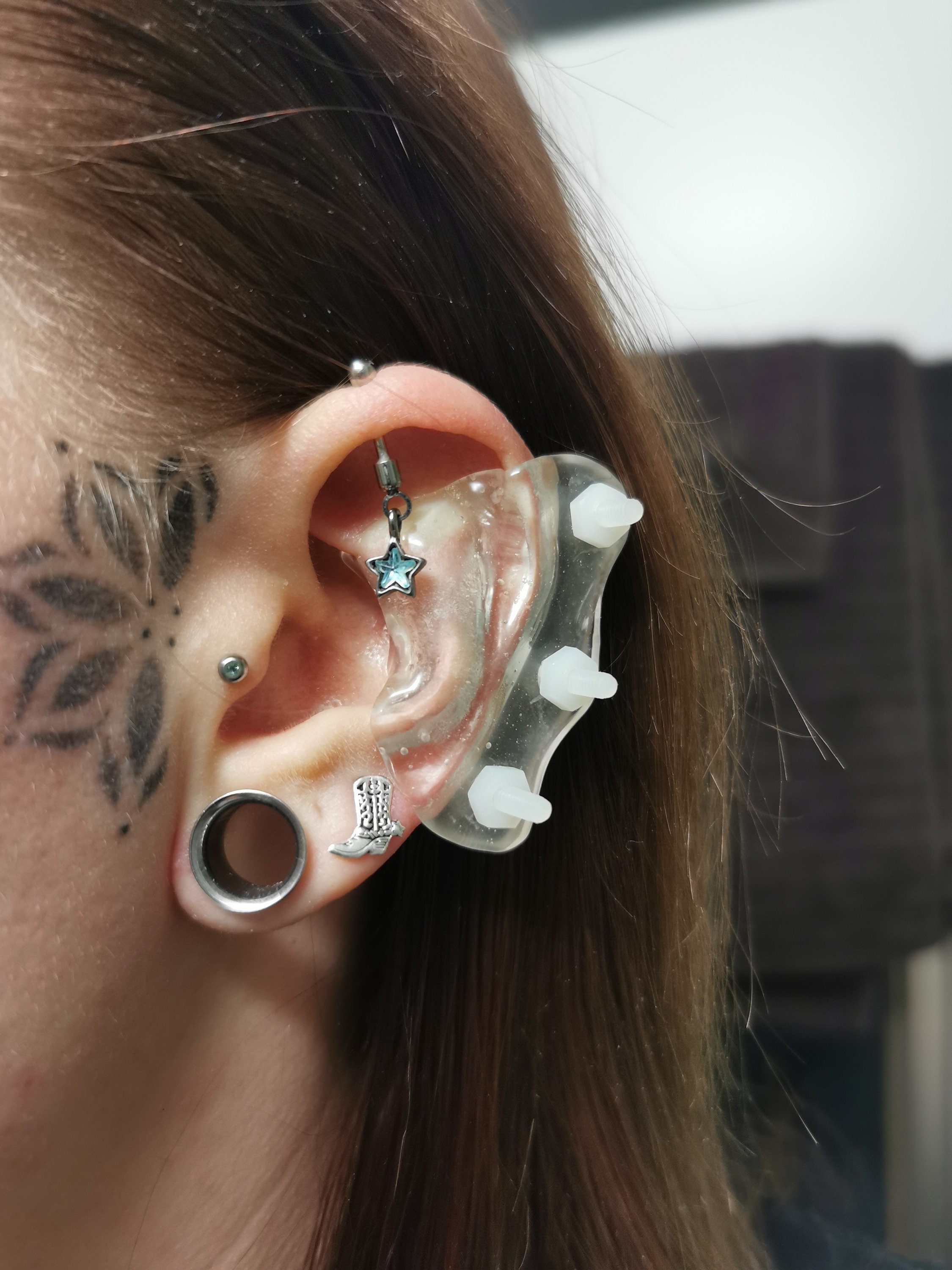 Ear Keloid Custom Acrylic Compression Pressure Earring Made - Etsy Hong ...