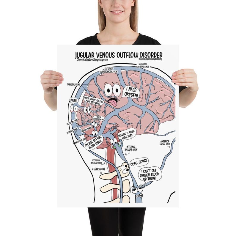 Jugular Venous Outflow Disorder Funny Diagram Poster - Etsy