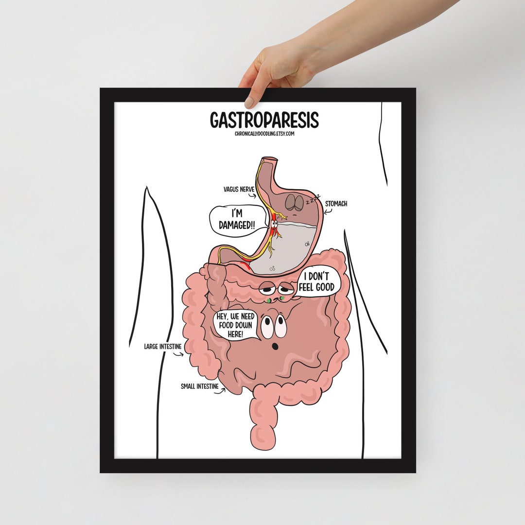 Gastroparesis Funny Medical Diagram Cartoon Framed Poster - Etsy
