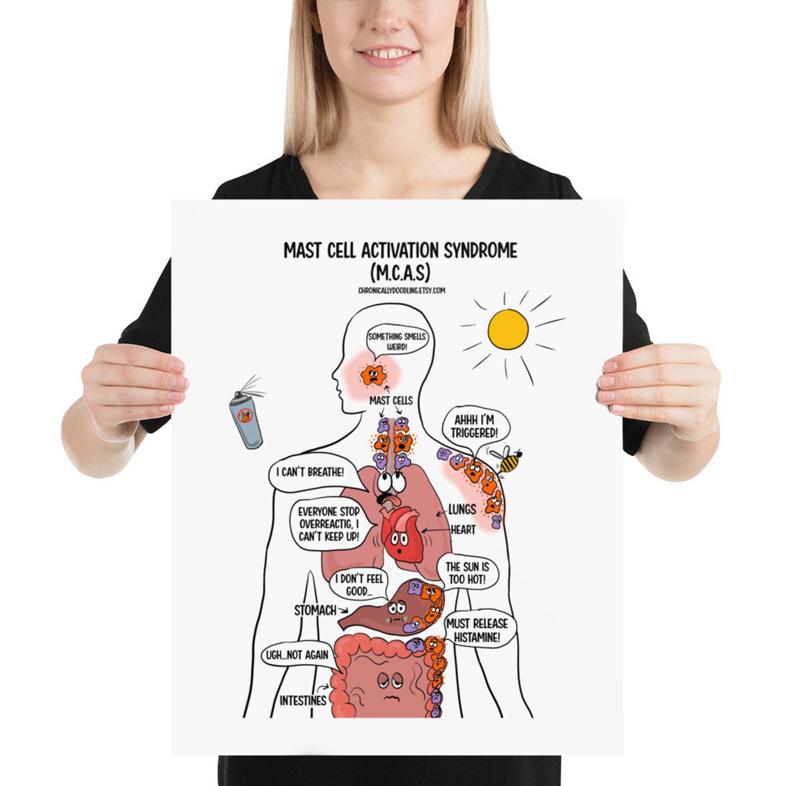 Mast Cell Activation Syndrome MCAS Poster - Etsy