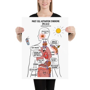 Mast Cell Activation Syndrome MCAS Poster - Etsy