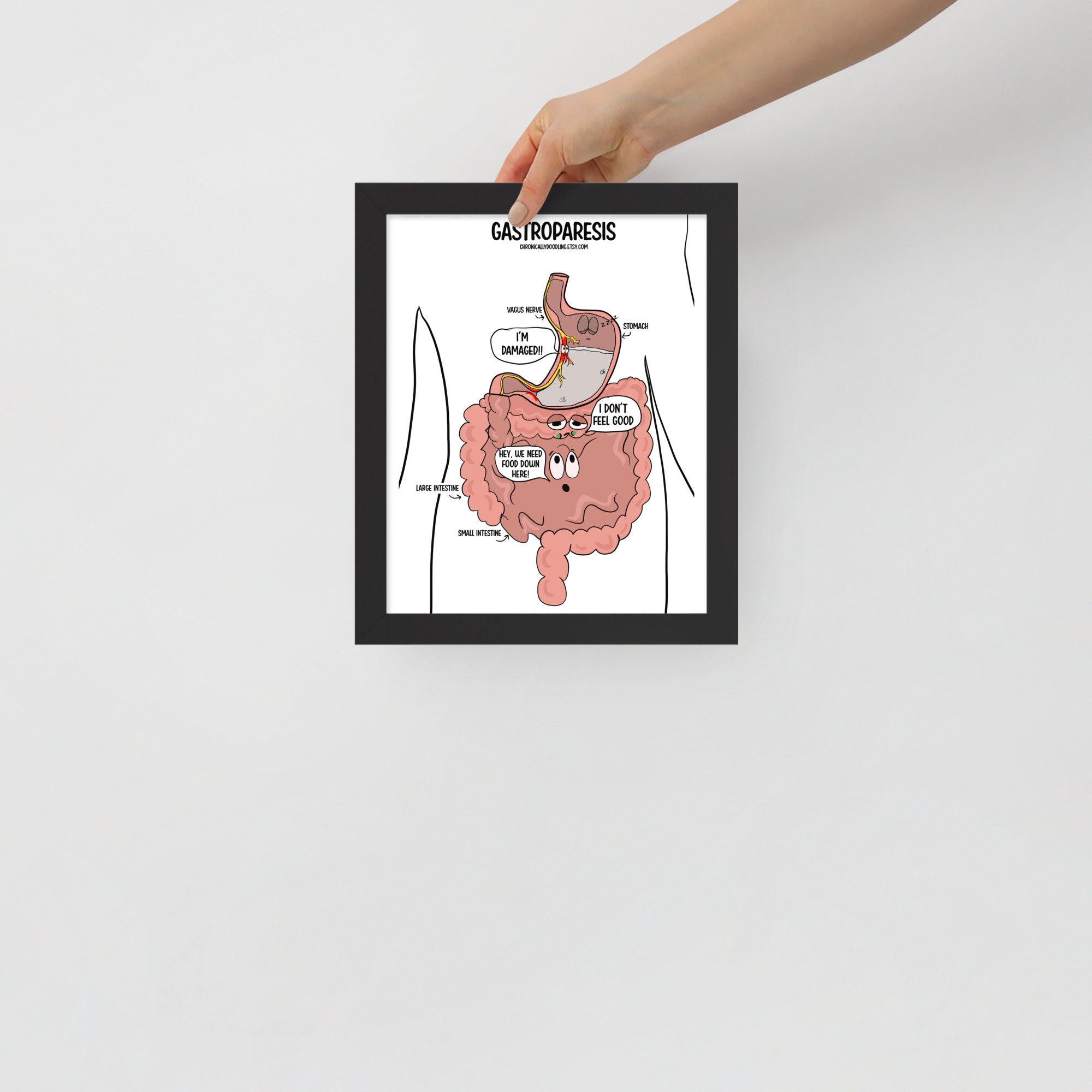 Gastroparesis Funny Medical Diagram Cartoon Framed Poster - Etsy