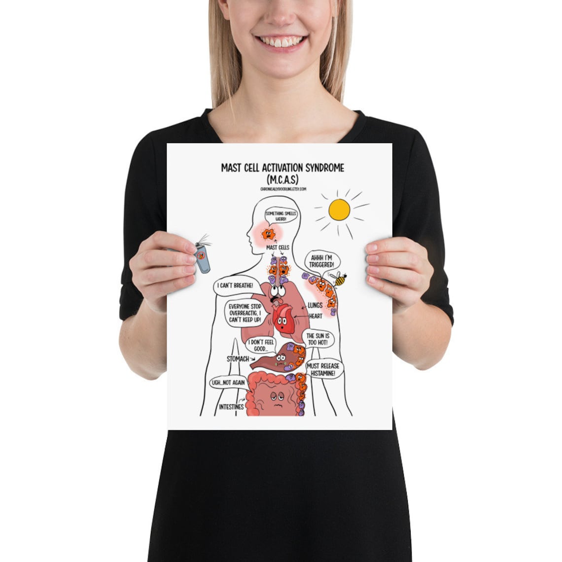 Mast Cell Activation Syndrome MCAS Poster - Etsy
