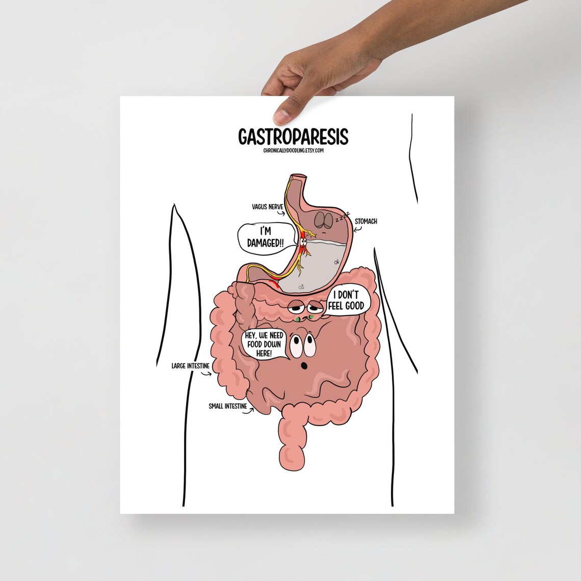 Gastroparesis Funny Medical Diagram Cartoon Poster - Etsy