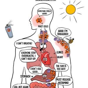 Mast Cell Activation Syndrome MCAS Poster - Etsy