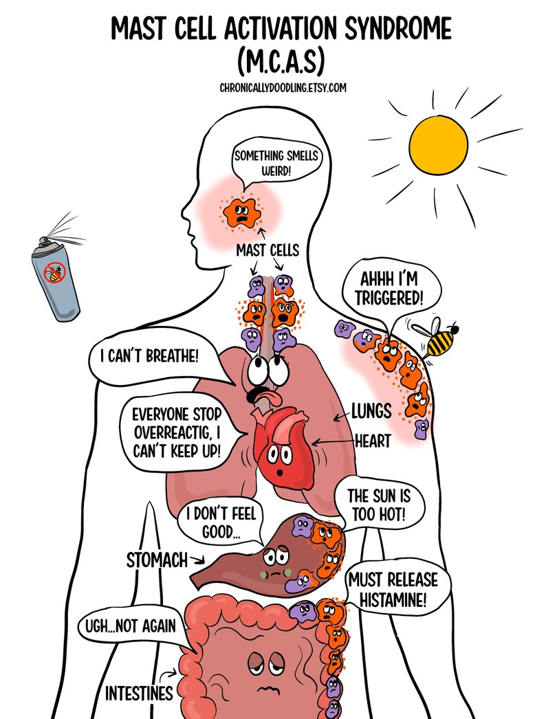 Mast Cell Activation Syndrome MCAS Poster - Etsy