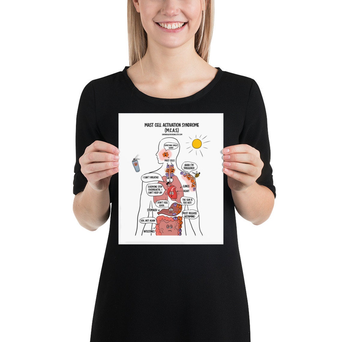 Mast Cell Activation Syndrome MCAS Poster - Etsy