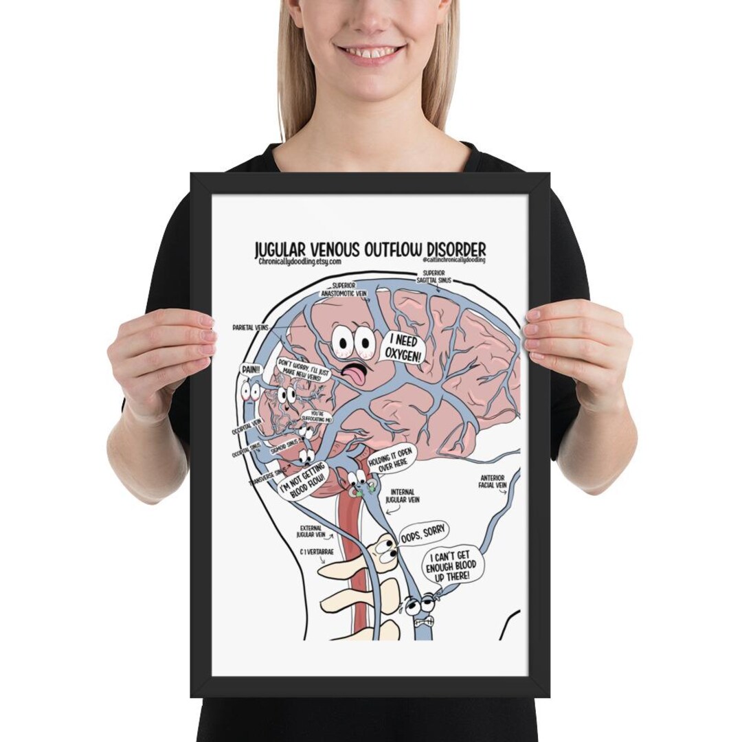 Jugular Venous Outflow Disorder Funny Diagram Framed Poster - Etsy
