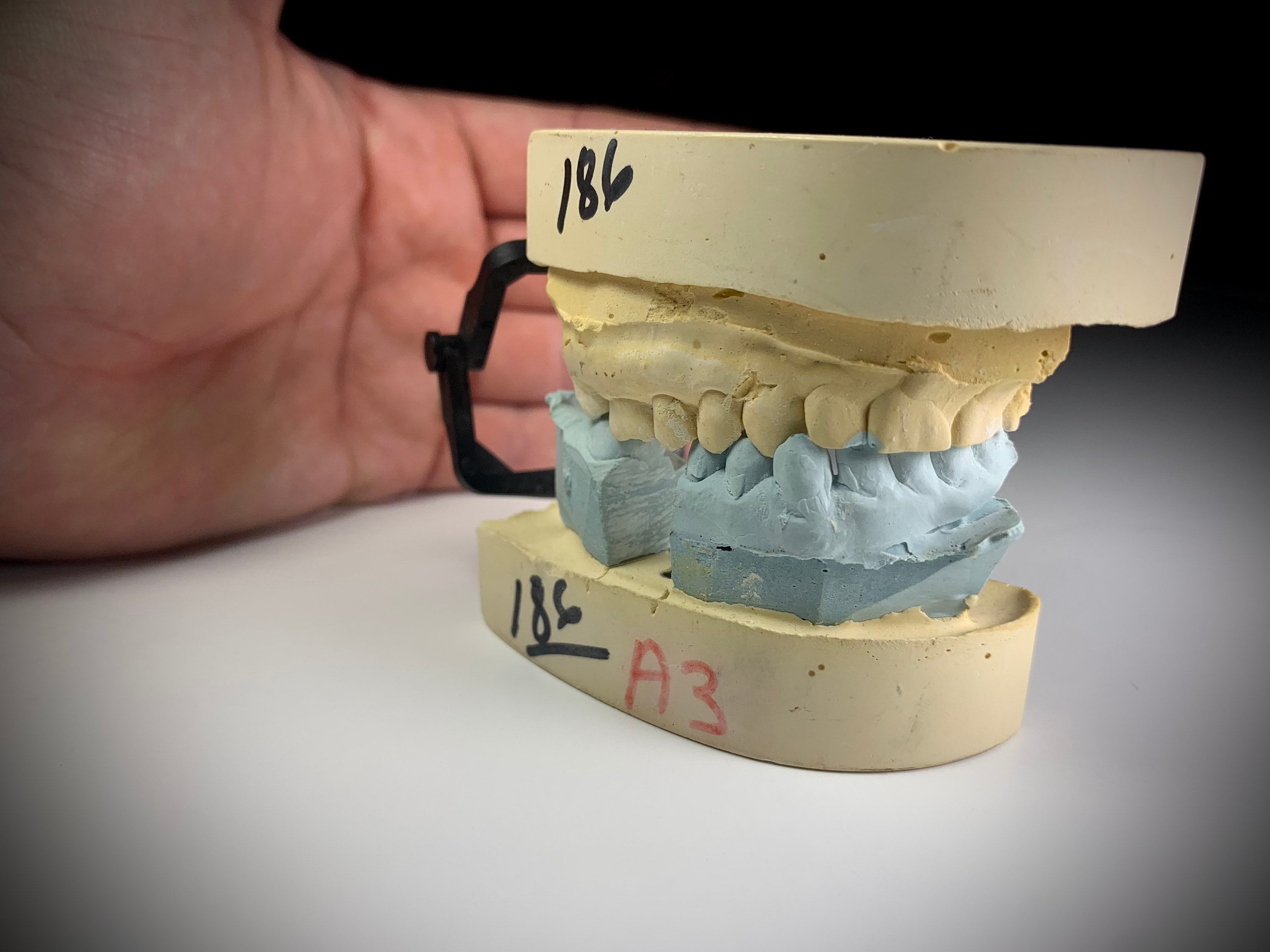 Hinged Plaster Cast Teeth Molds. Great Prop. & Aesthetic - Etsy