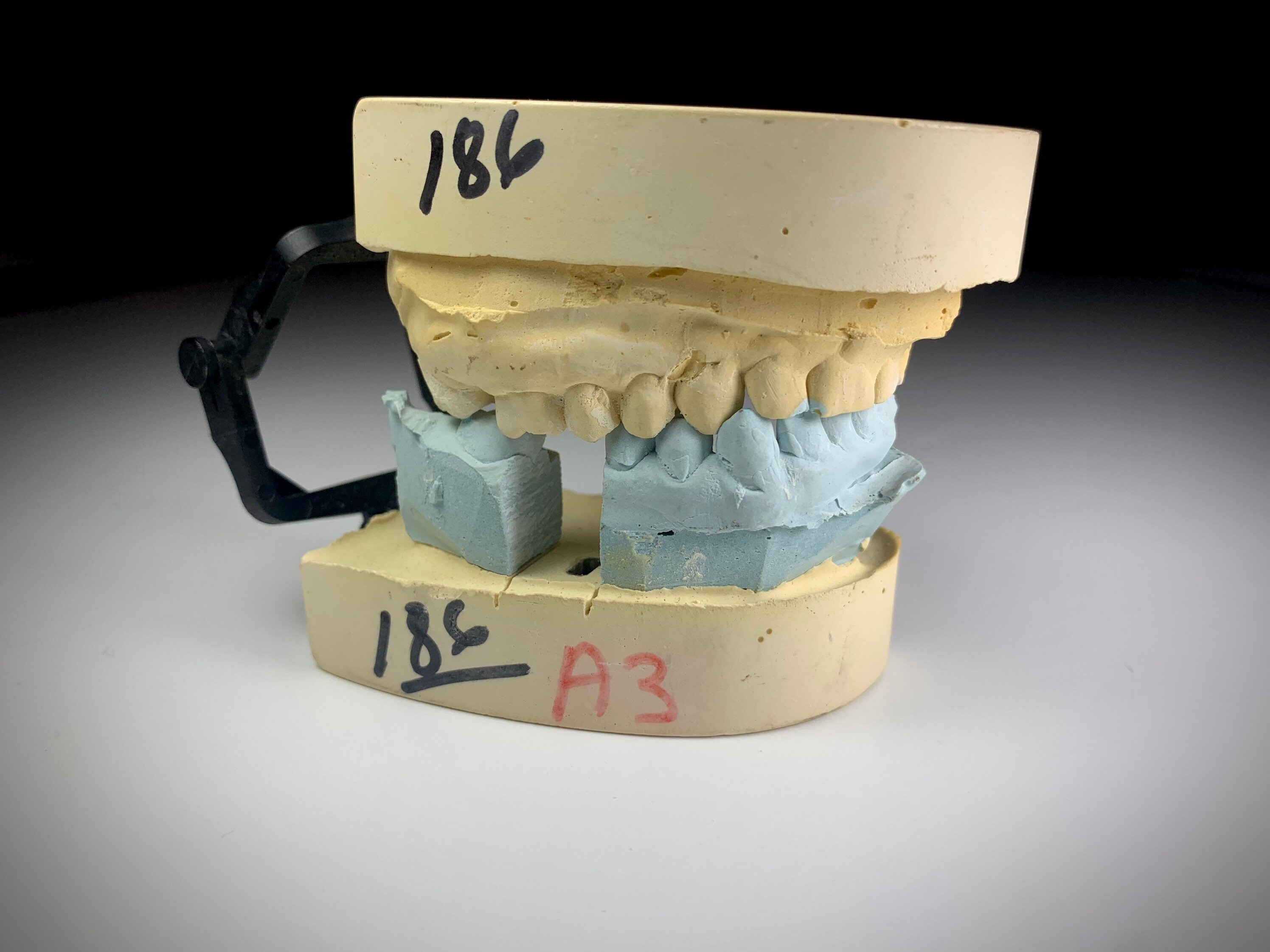 Hinged Plaster Cast Teeth Molds. Great Prop. & Aesthetic - Etsy
