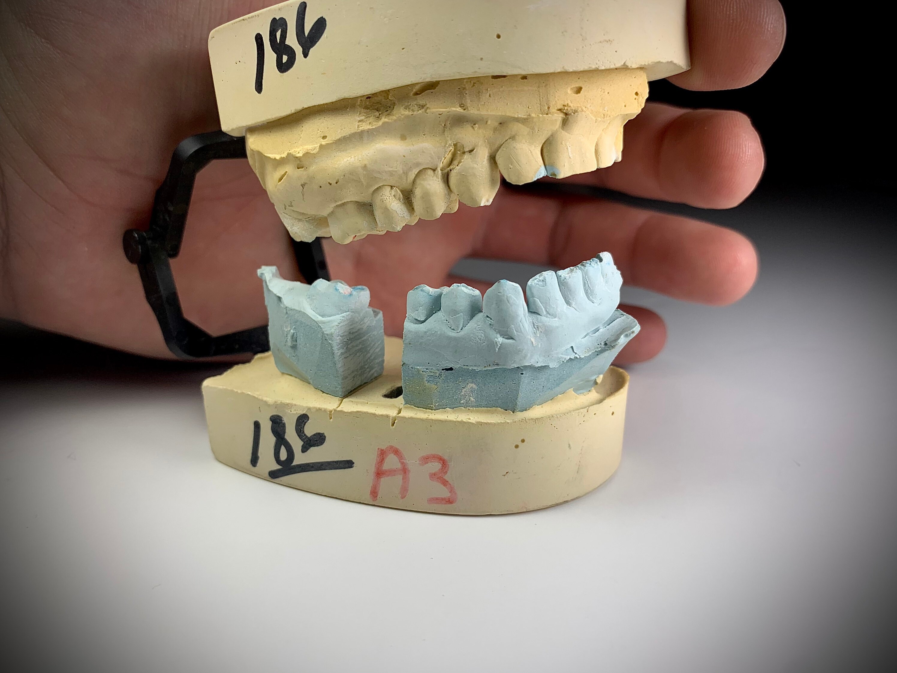 Hinged Plaster Cast Teeth Molds. Great Prop. & Aesthetic - Etsy
