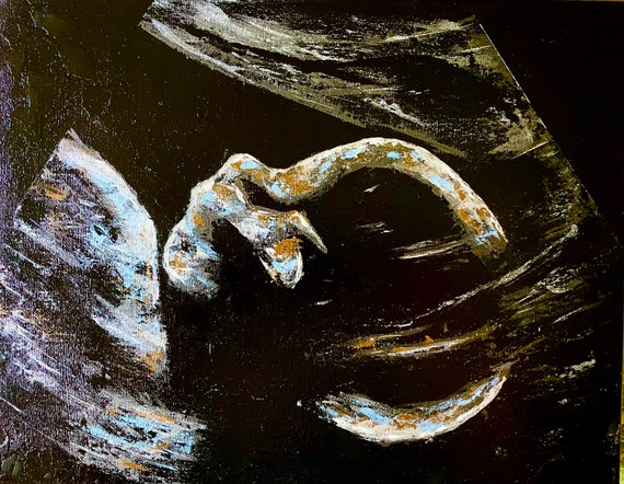 Custom Sonogram Painting Baby Art Angel Baby Ultrasound | Etsy