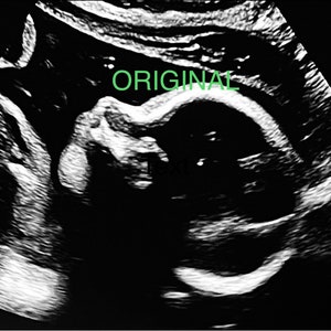 Custom Sonogram Painting, Baby Art, Angel Baby, Ultrasound Art ...