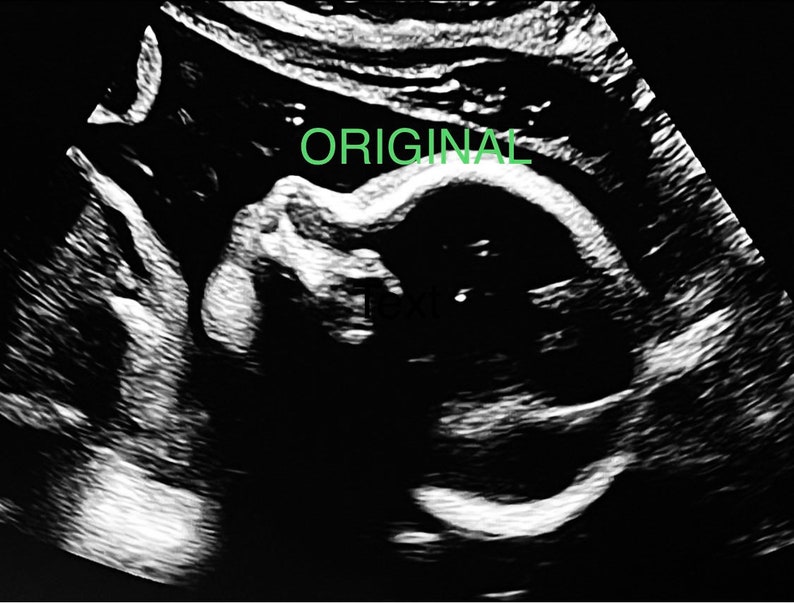 Custom Sonogram Painting, Baby Art, Angel Baby, Ultrasound Art ...