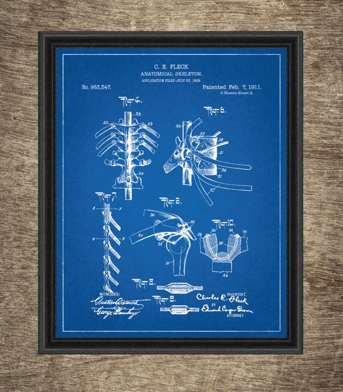 Human Anatomy Blueprint Poster Nursery Wall Decor Poster - Etsy