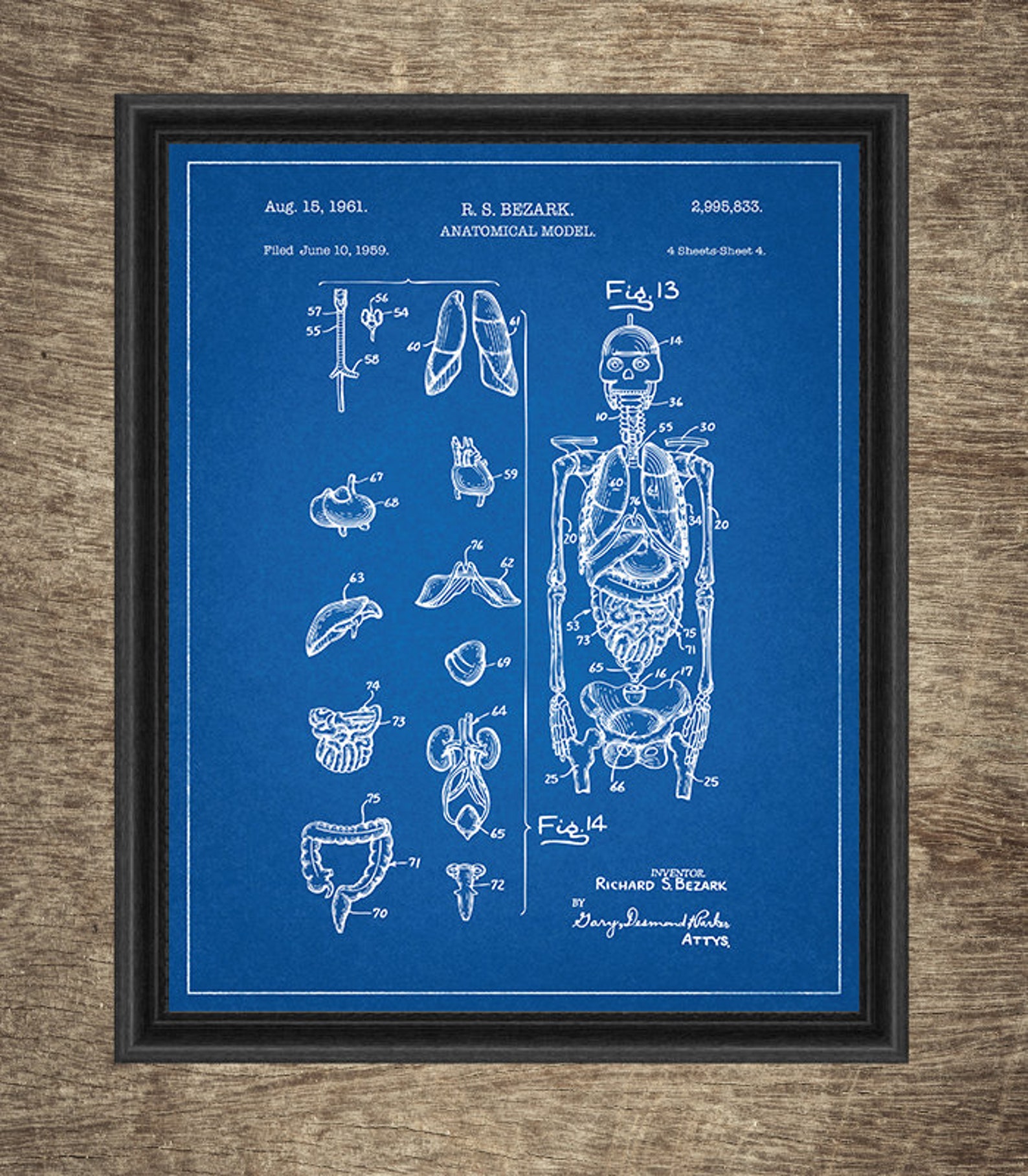 Printable Human Anatomy Art Set of 4 Blueprints Doctor Wall | Etsy