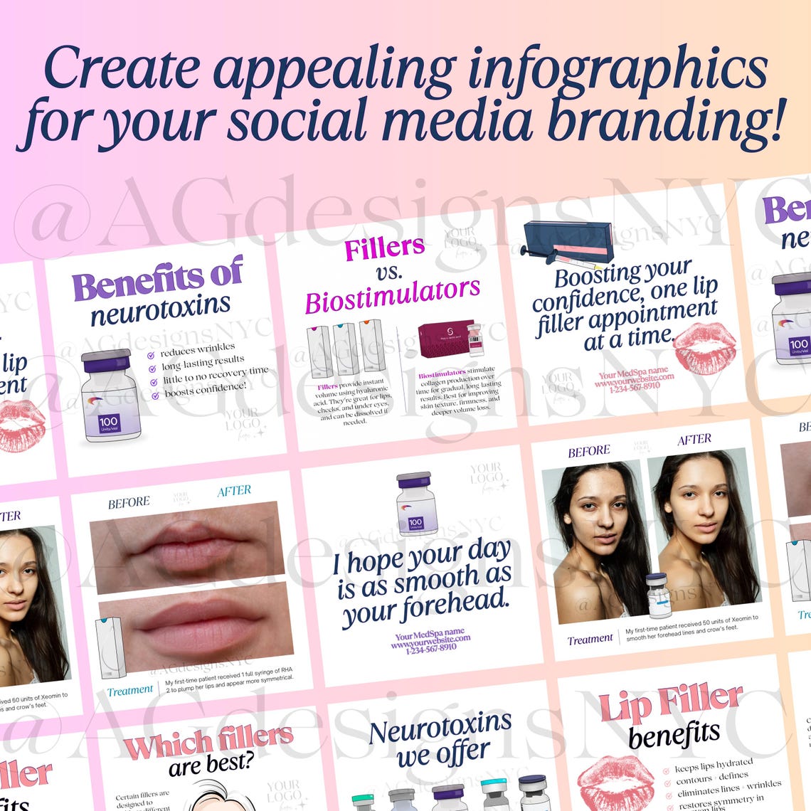 Ultimate Injector Illustration Pack | Neurotoxin, Dermal Filler ...