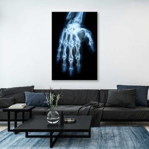 X-ray Human Hand – Anatomy Wall Decor, Radiology Photo Canvas Print ...