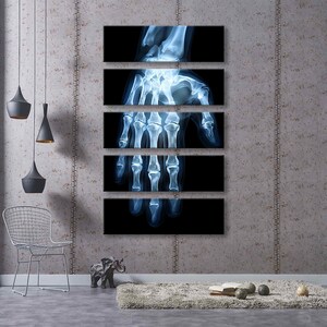 X-ray Human Hand – Anatomy Wall Decor, Radiology Photo Canvas Print ...