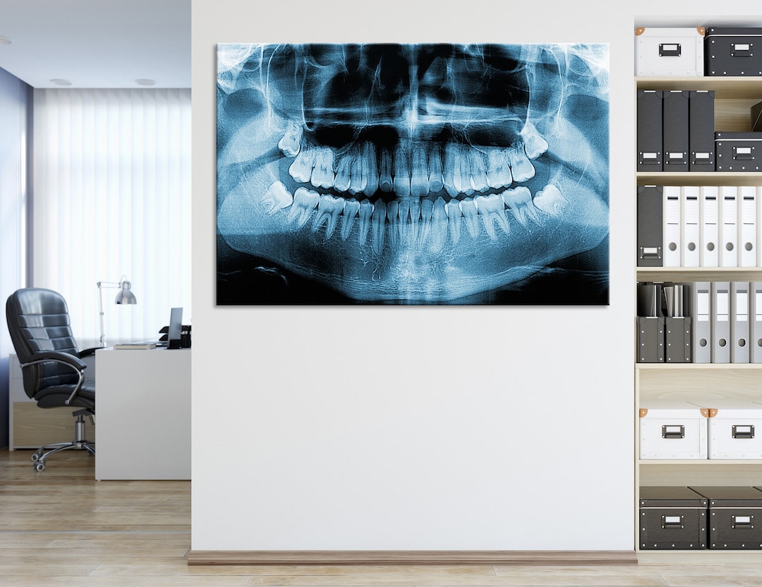 Panoramic Dental Tooth X-ray Canvas, Wall Art for Dental Office, Large Wall Decor - Etsy