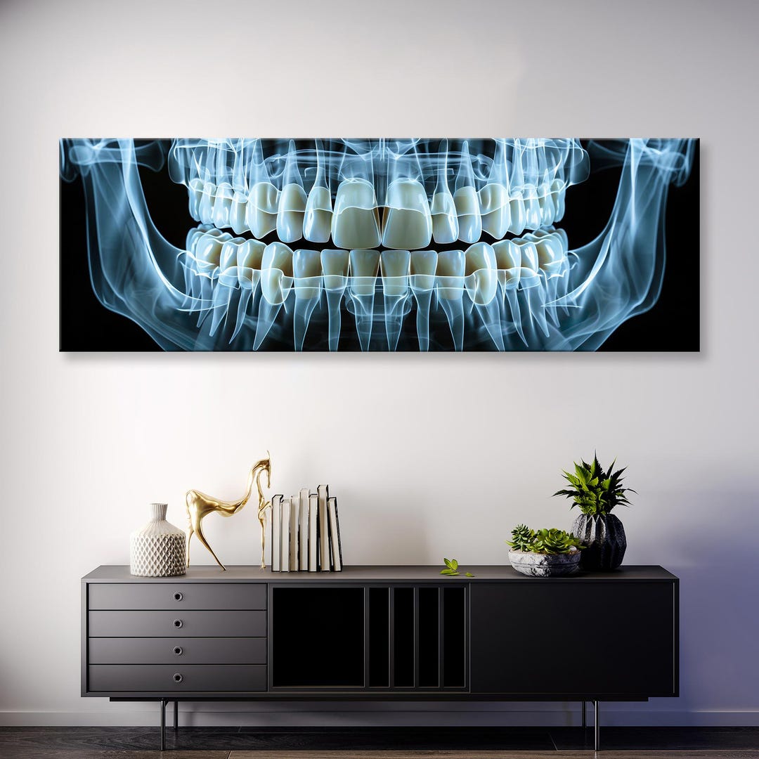 Extra Wide Panoramic X-ray Jaw Canvas Print - Snow-white Healthy Teeth ...
