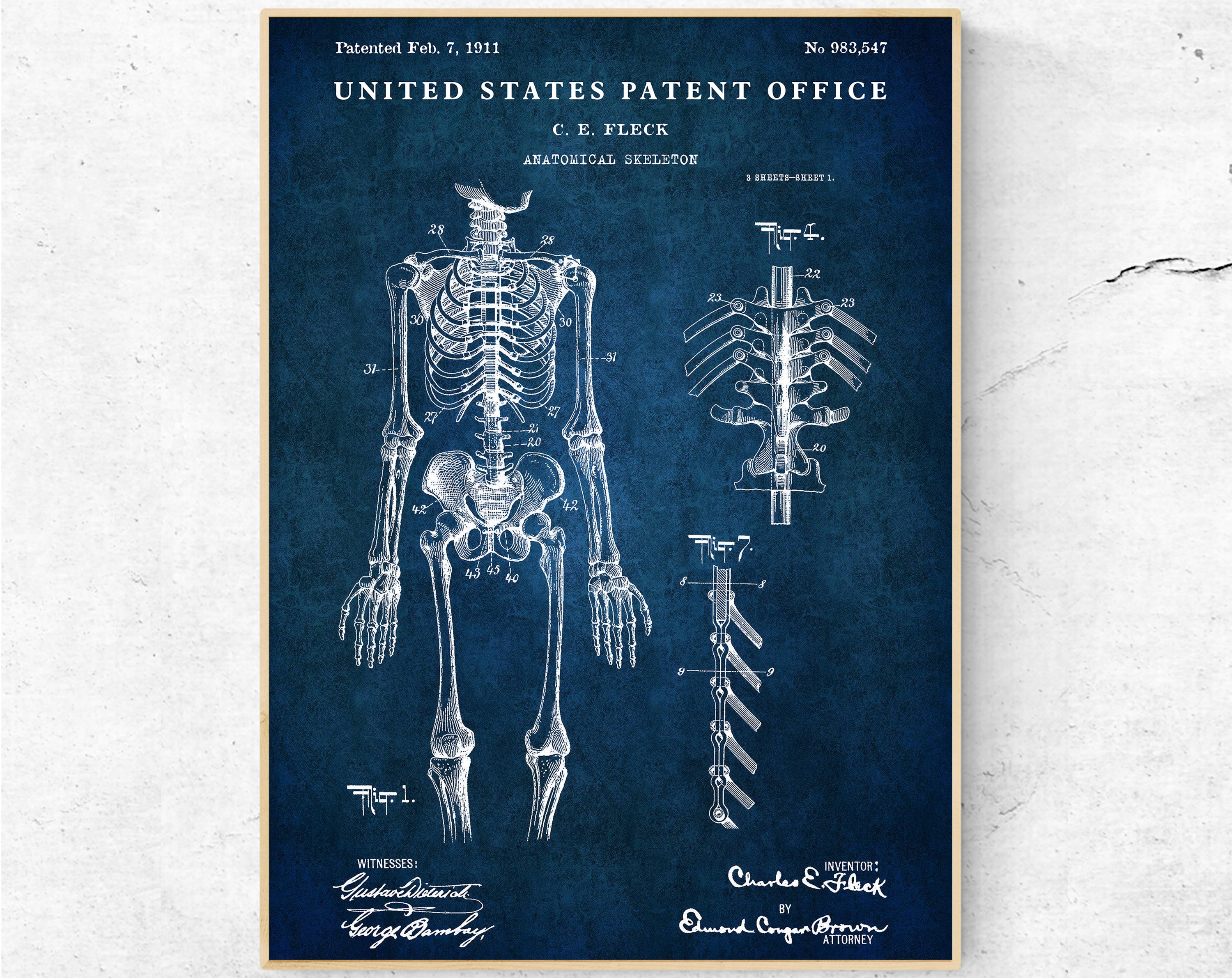 Anatomical Skeleton 1911 Patent Drawing Print. Doctor Office, Medical ...