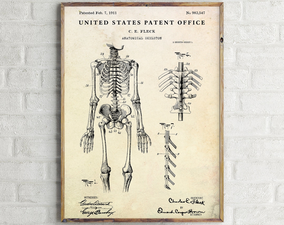Skeleton 1911 Patent Drawing Wall Art. Doctor Office Vintage Decor ...