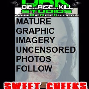 Zombie 1/4 Face Latex Prosthetic "sweet Cheeks" Created by DRK Studios ...