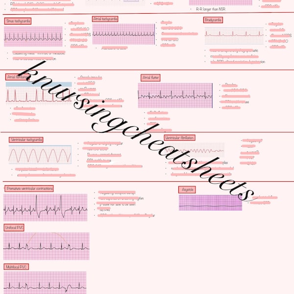 Ekg Cheat Sheet - Etsy