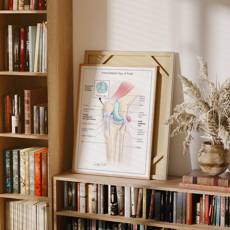 Medical Art Human Knee Anatomy Wall Art Medical Illustration Print ...