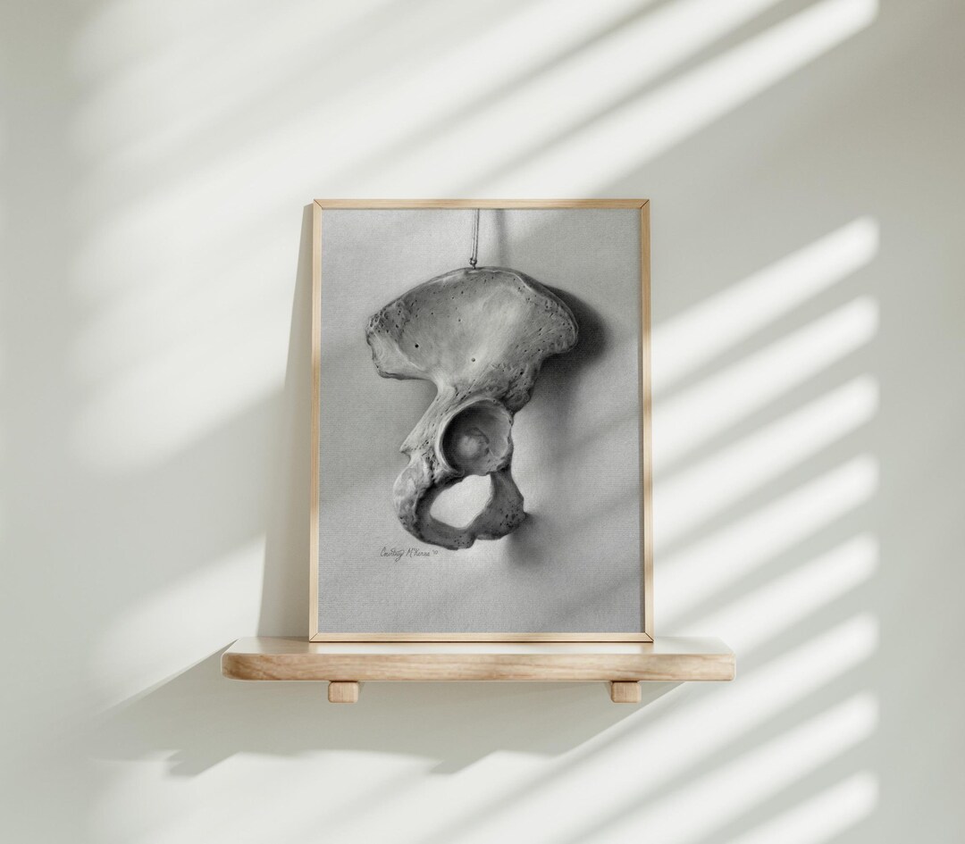 Medical Art Hip Bone Drawing Wall Art Medical Illustration Print Wall ...