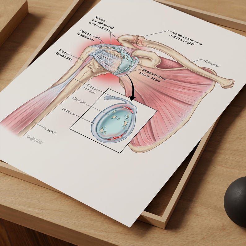 Shoulder Joint Anatomy Wall Art, Shoulder Muscles Medical Illustration ...
