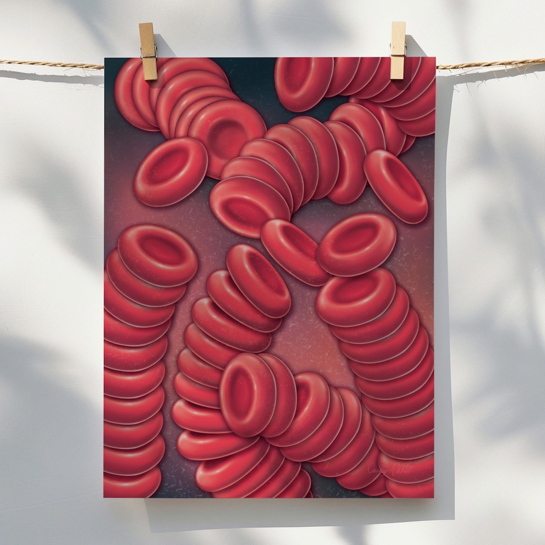 Red Blood Cells Art Print, Medical Illustration Wall Decor, Hematology ...