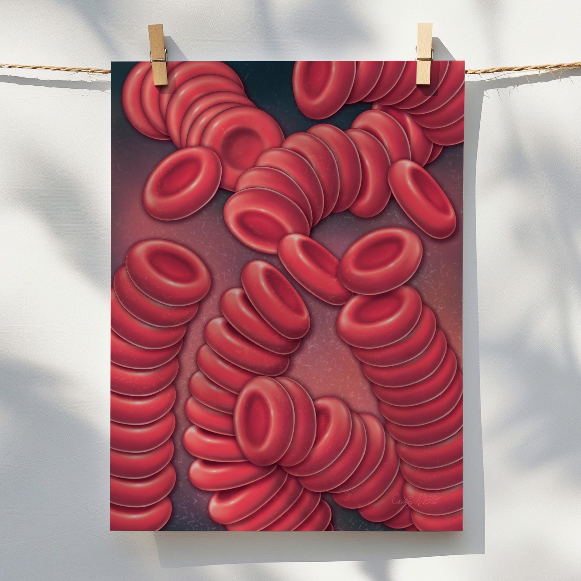Red Blood Cells Art Print, Medical Illustration Wall Decor, Hematology ...
