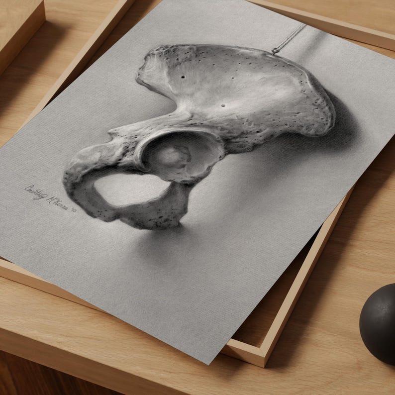 Medical Art Hip Bone Drawing Wall Art Medical Illustration Print Wall ...